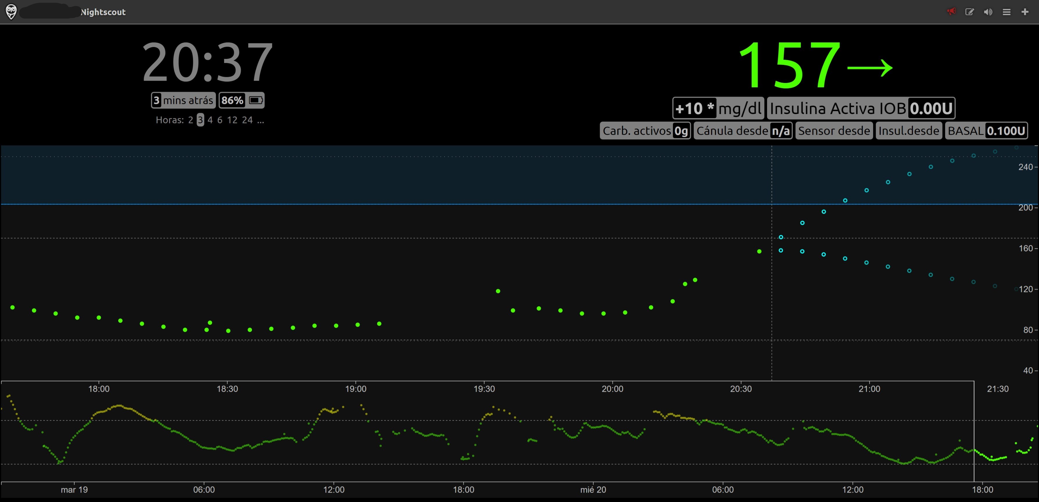 Diabox. The App that measures your glucose continuously and shares it via Nightscout. – Digital ...