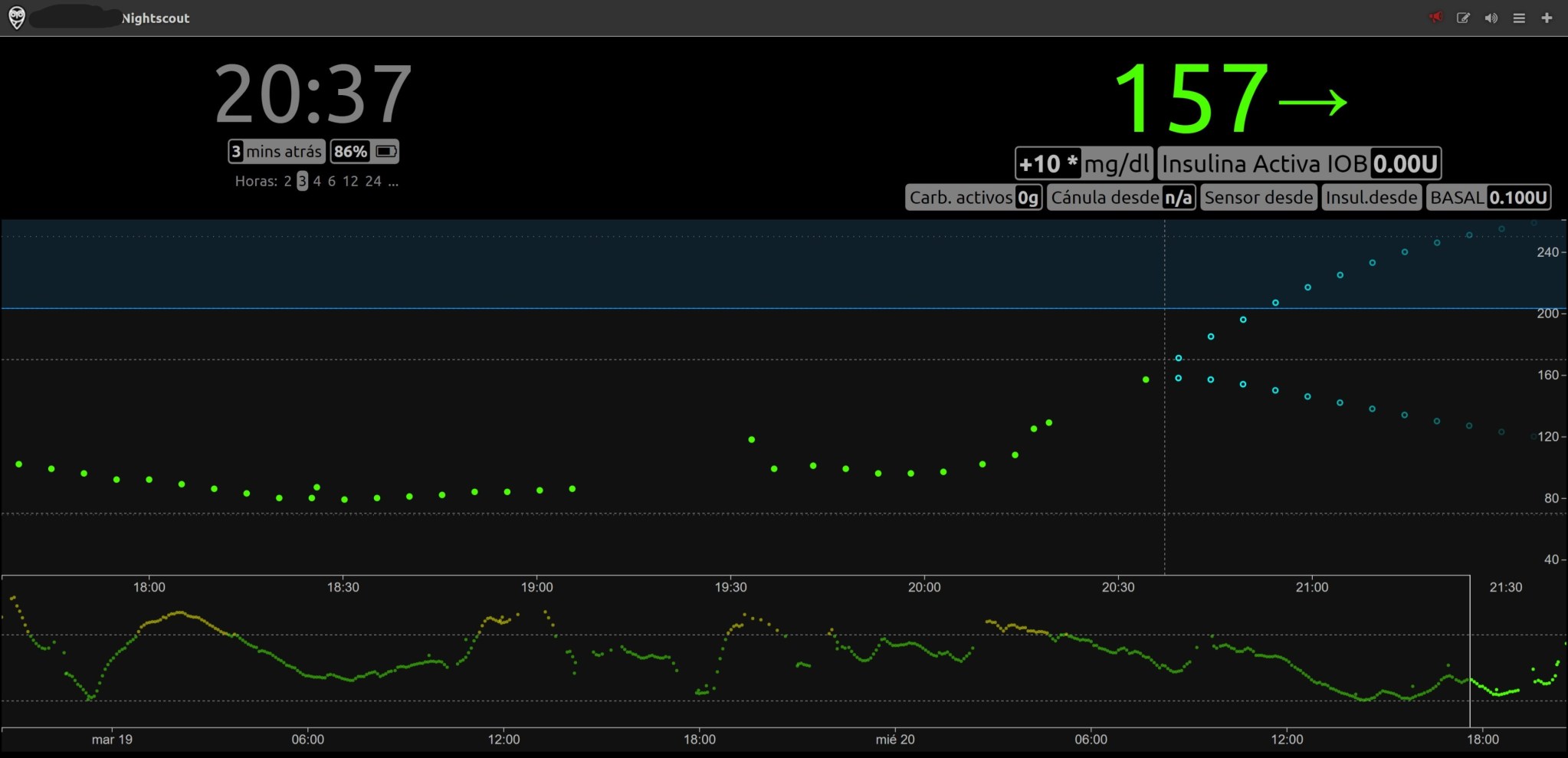 Diabox. The App that measures your glucose continuously and shares it via Nightscout. – Digital ...